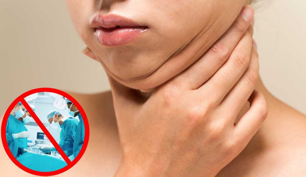 Doppio mento: c'è la soluzione! Addio chirurgia con 4 rimedi ...